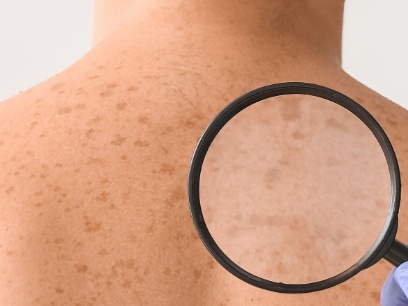 Cellmune 1 mg/g pomada | Cantabria Labs España